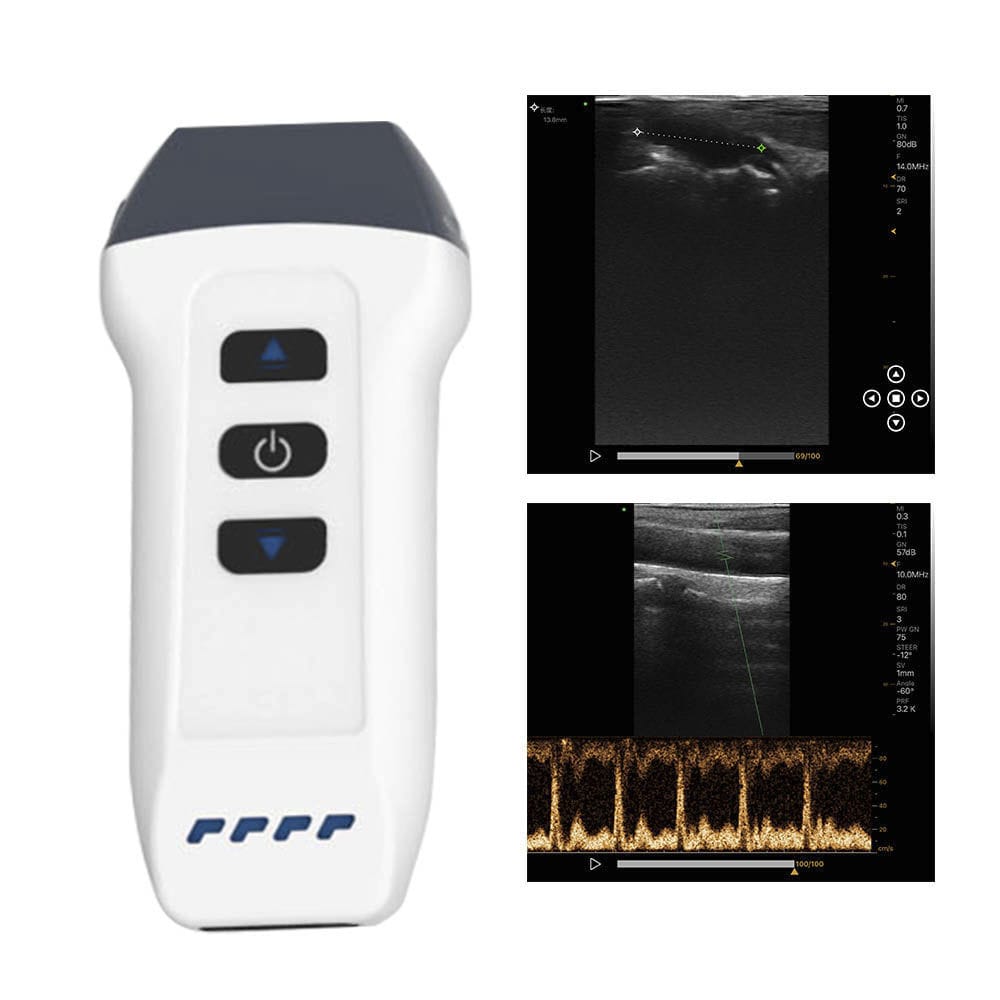 Портативный ультразвуковой сканер - DW-L2 - Dawei Medical - для костно ...