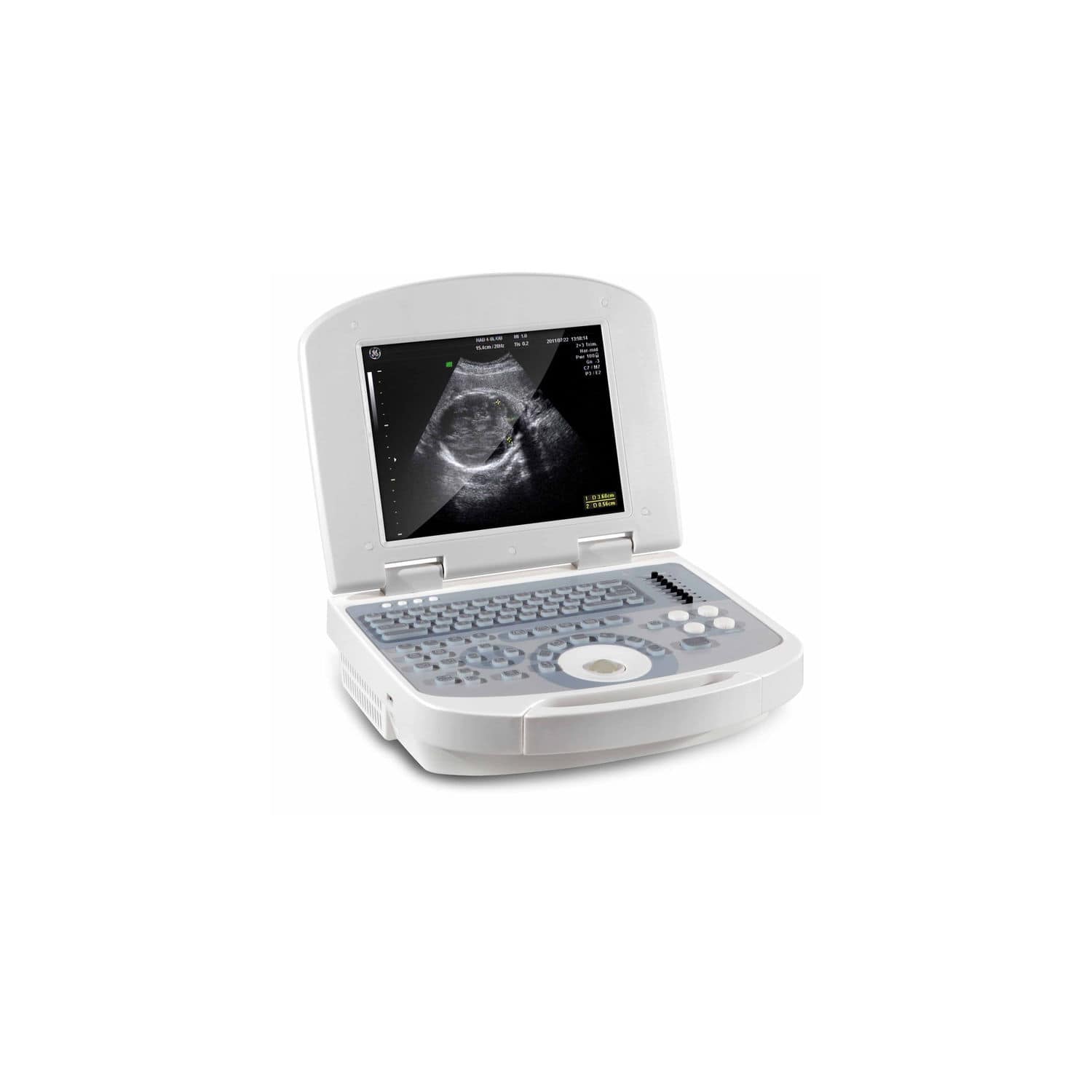 Переносной ветеринарный ультразвуковой сканер - V2200 - Sunway Medical ...