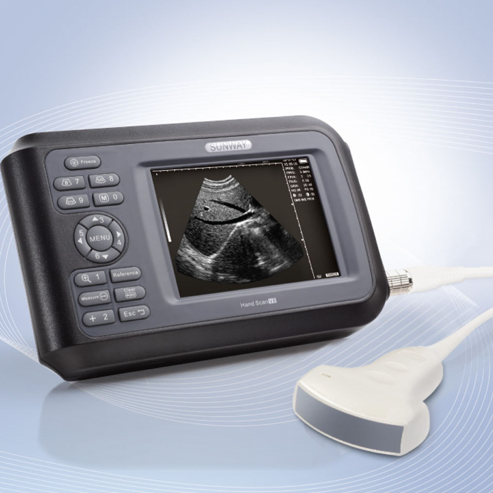 Портативный ультразвуковой сканер - Handscan H8 - Sunway Medical - для ...