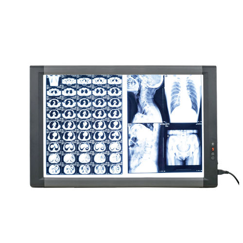 Цифровой негатоскоп - MG02 - Nanchang Micare Medical Equipment - 2 ...